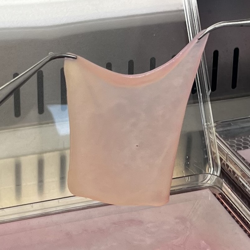 Artificial skin breakthrough for Melbourne patient | Bayside Health ...