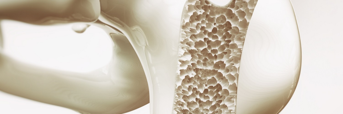 DEXA scan | Alfred Health